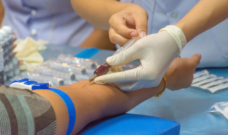 Blood Testing For IGF-1 Levels