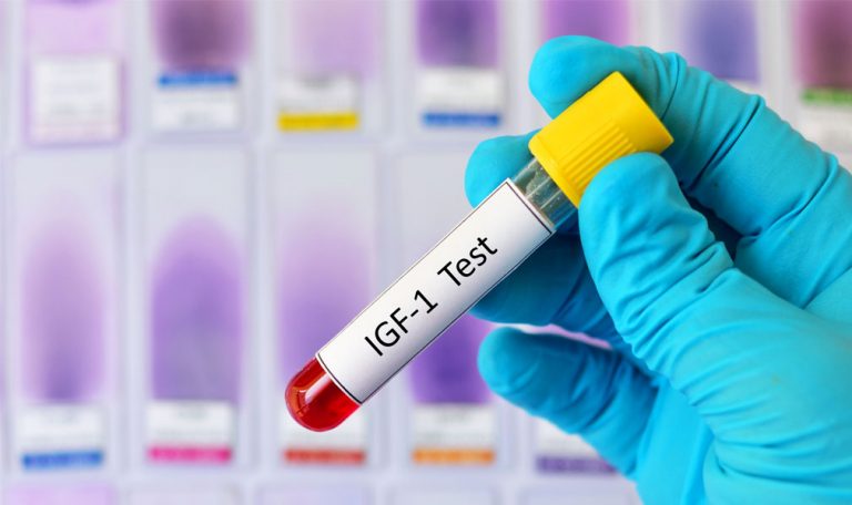 Blood Testing For IGF-1 Levels
